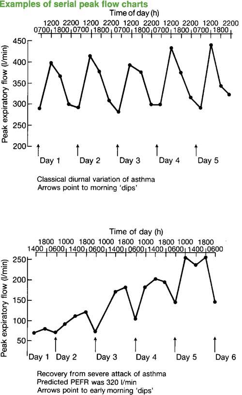 Peak Flow Recording: Diagnosis of Asthma | Doctor