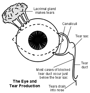 Watering Eyes (Epiphora): Causes and Treatment