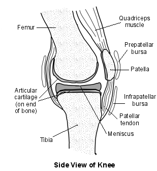 Prepatellar Bursitis (Causes, Symptoms, and Treatment)