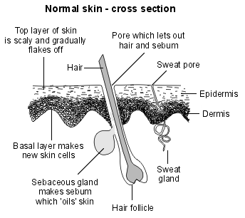Heat Rash (Prickly Heat): Symptoms, Causes, and Treatment