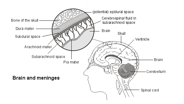 Subarachnoid Haemorrhage: Signs and Treatment | Doctor