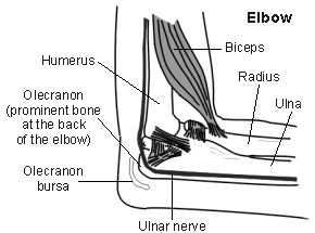 Olecranon Bursitis: Symptoms, Causes, and Treatment