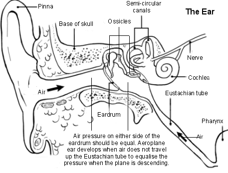 Aeroplane Ear: Symptoms, Causes, and Treatment