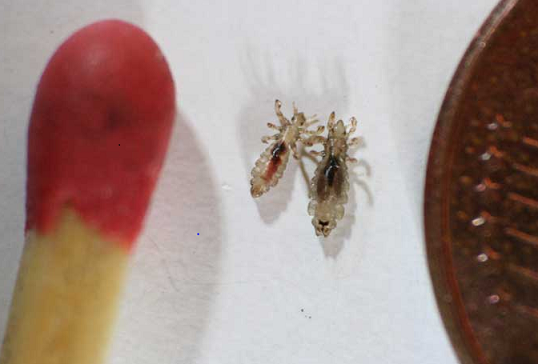 Head Lice and Nits: Signs, Detection and Treatment