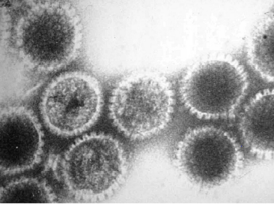Herpes Viruses (Types, Symptoms, Epidemiology)